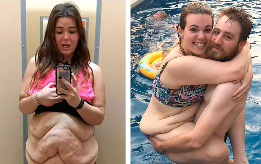 10 chicas mostraron honestamente lo que sucede con la piel después de la pérdida de peso