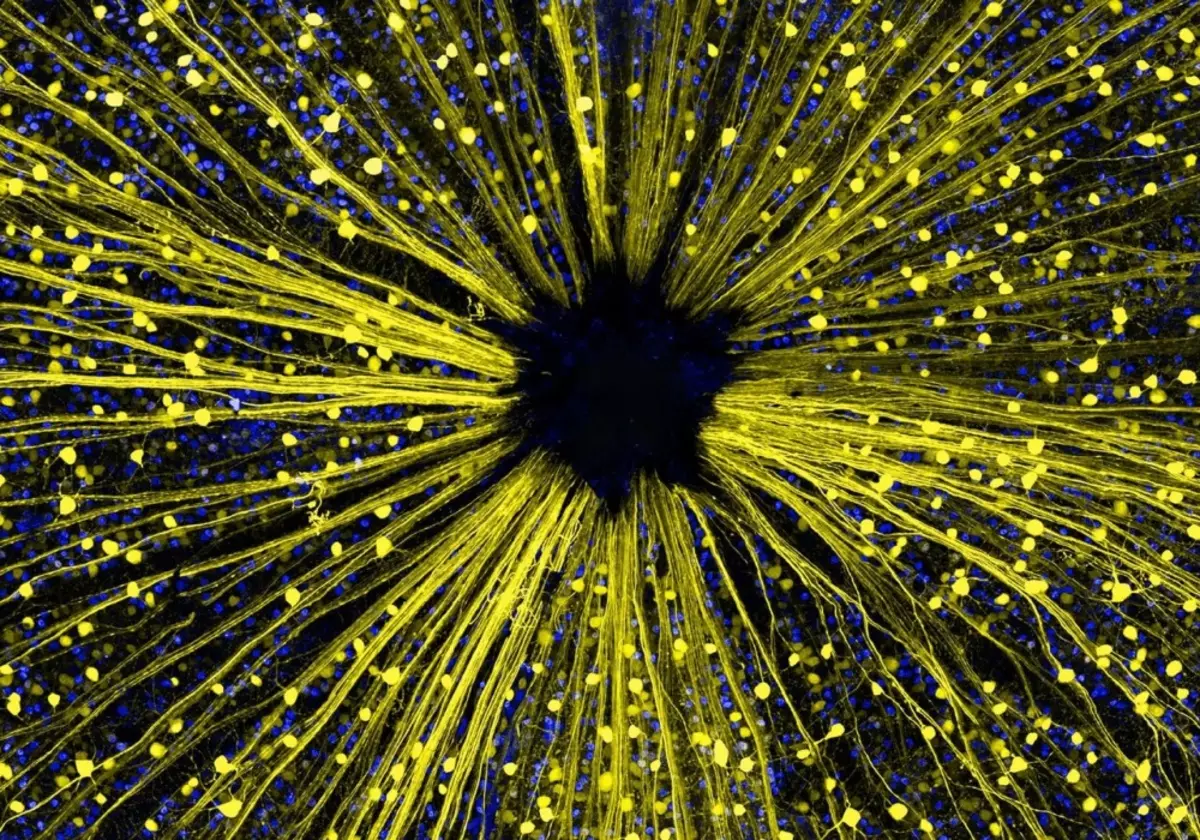 Snapshots sub microscop