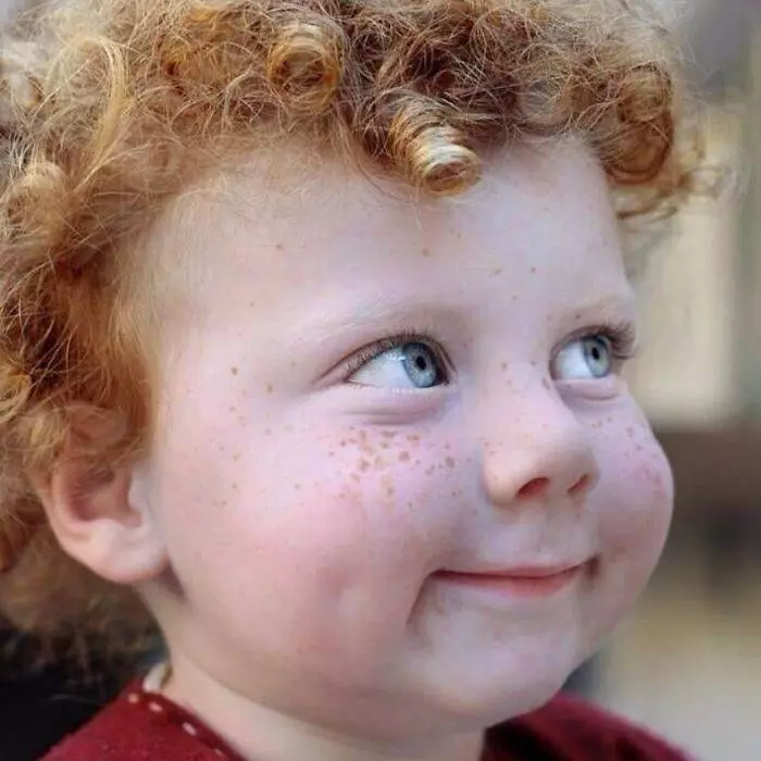 تصویر 11 - 20 تصاویر ثابت کرتی ہیں کہ Freckles کے ساتھ لوگوں کو جادوگر خوبصورت ہیں