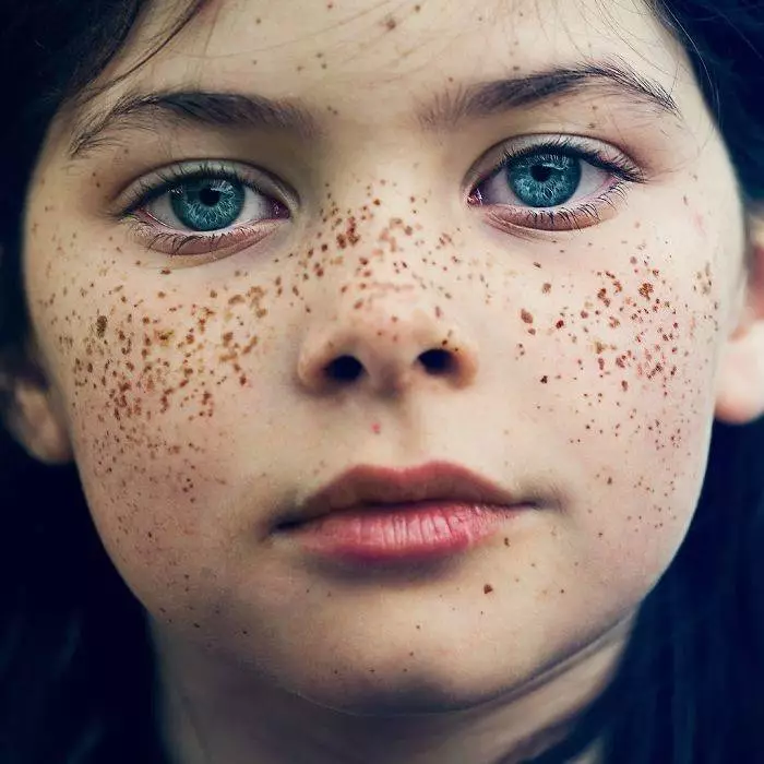 تصویر 16 - 20 تصاویر ثابت کرتی ہیں کہ Freckles کے ساتھ لوگوں کو جادوگر خوبصورت ہیں