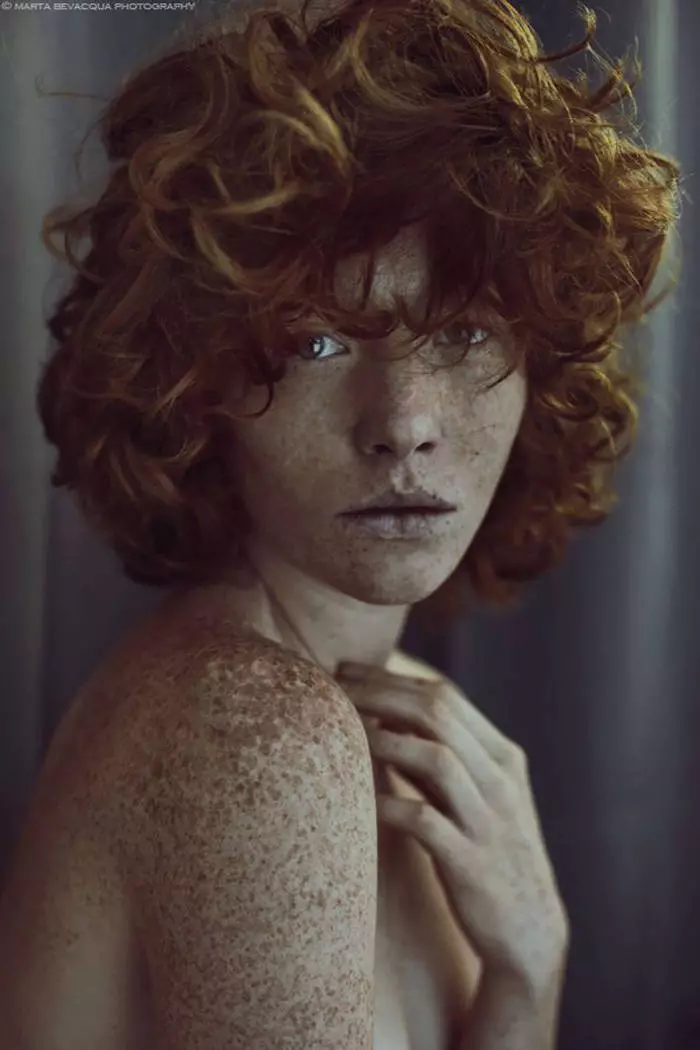 Şəkil 19 - 20 fotoşəkildə freckles olan insanların sehrli şəkildə gözəl olduğunu sübut edir