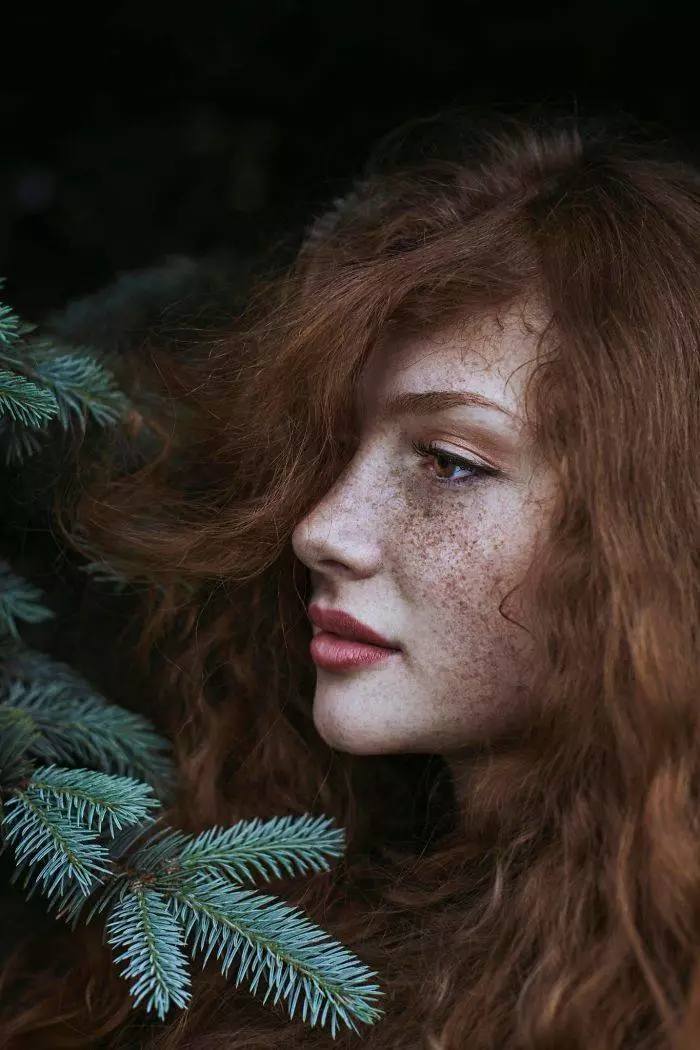 photo 7 - 20 photos prouvant que les personnes avec des taches de rousseur sont magiquement belles