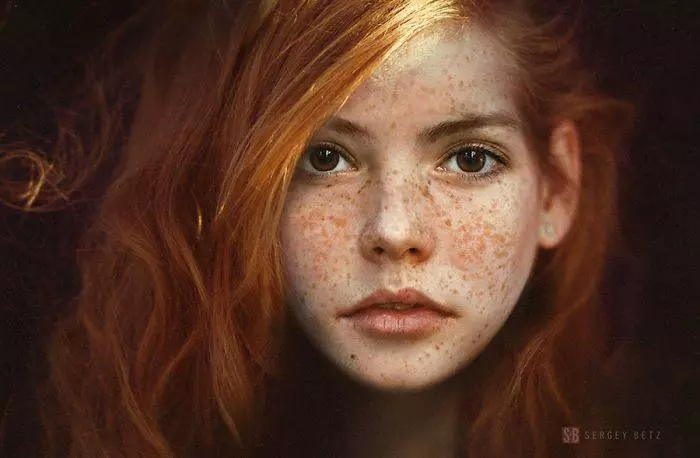 Şəkil 8 - 20 Freckles olan insanların sehrli şəkildə gözəl olduğunu sübut edən fotoşəkil