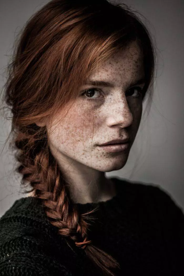 9. argazkia - 20 argazki frogatzen ditu freckles duten pertsonak magikoki ederrak direla