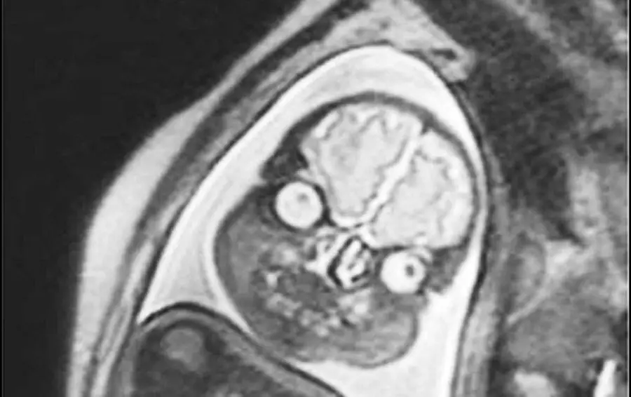 10 tembakan x-ray yang unik yang menunjukkan semua kekuatan penemuan ini