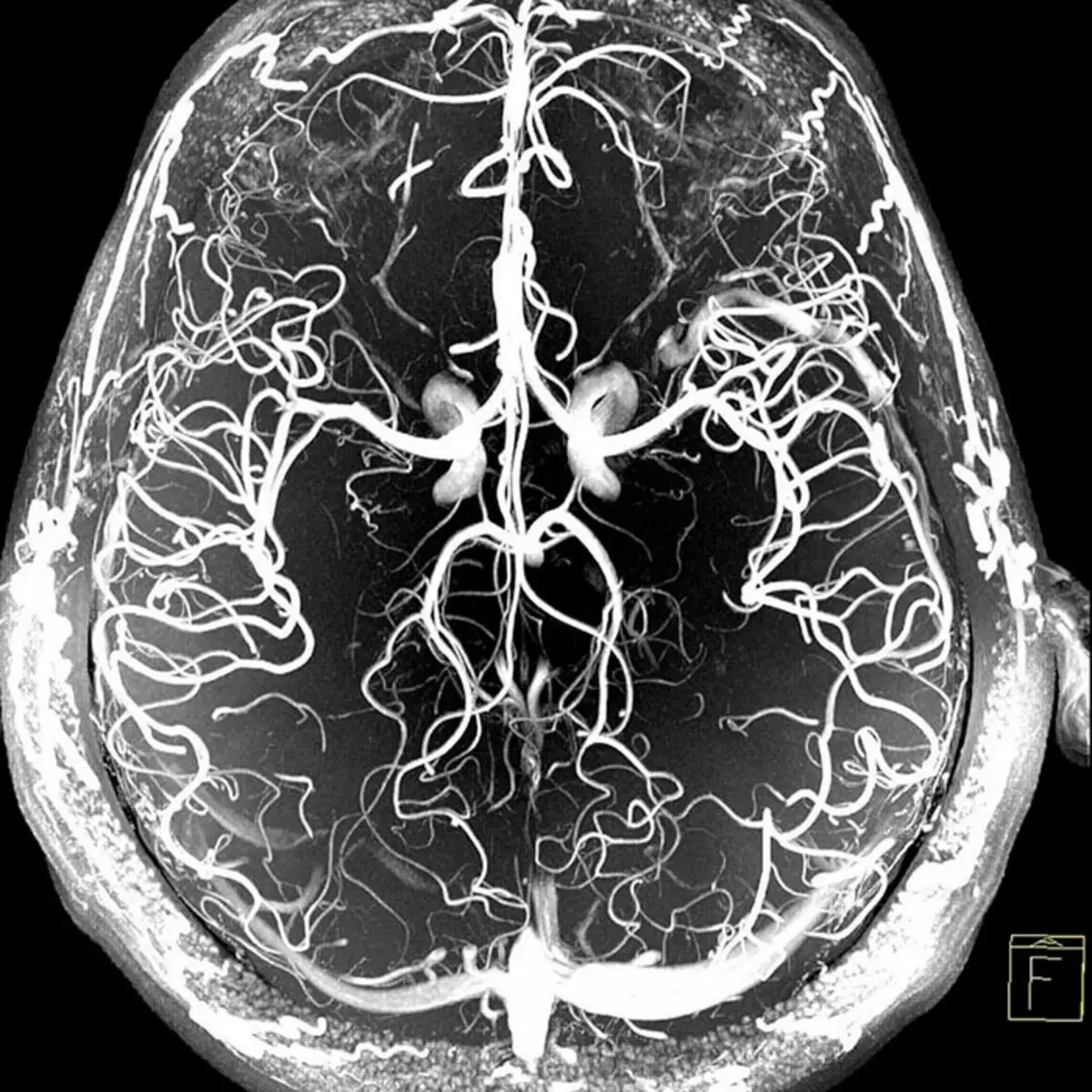 10 tembakan x-ray yang unik yang menunjukkan semua kekuatan penemuan ini