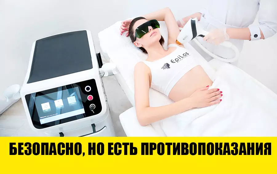 7 mythau am epilation laser sy'n cael eu dyddio'n ddi-hid